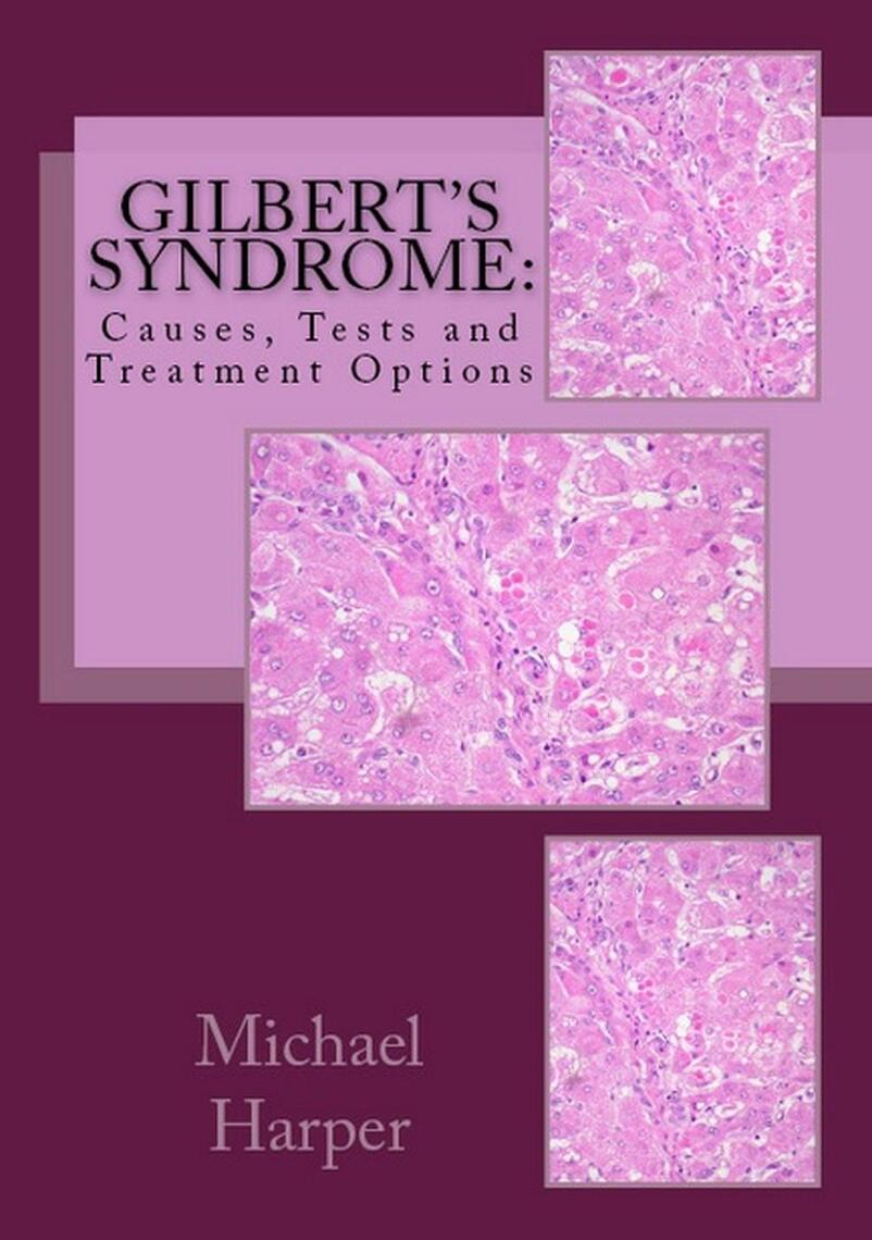 Gilbert's Syndrome: Causes, Tests and Treatment Options by Michael ...