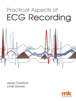 Ecg Made Ridiculously Easy! | PDF | Electrocardiography | Heart