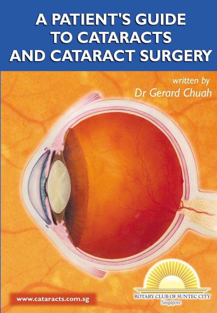 A Patient S Guide To Cataracts And Cataract Surgery By Dr Gerard Chuah