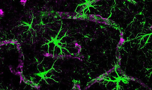 Sleep: When Brain Cells Shrink & Neuro Trash Is Flushed Away - Nautilus ...