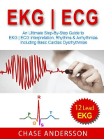 Basic EKG ECG Rhythms Cheatsheet | PDF | Electrocardiography | Cardiac ...
