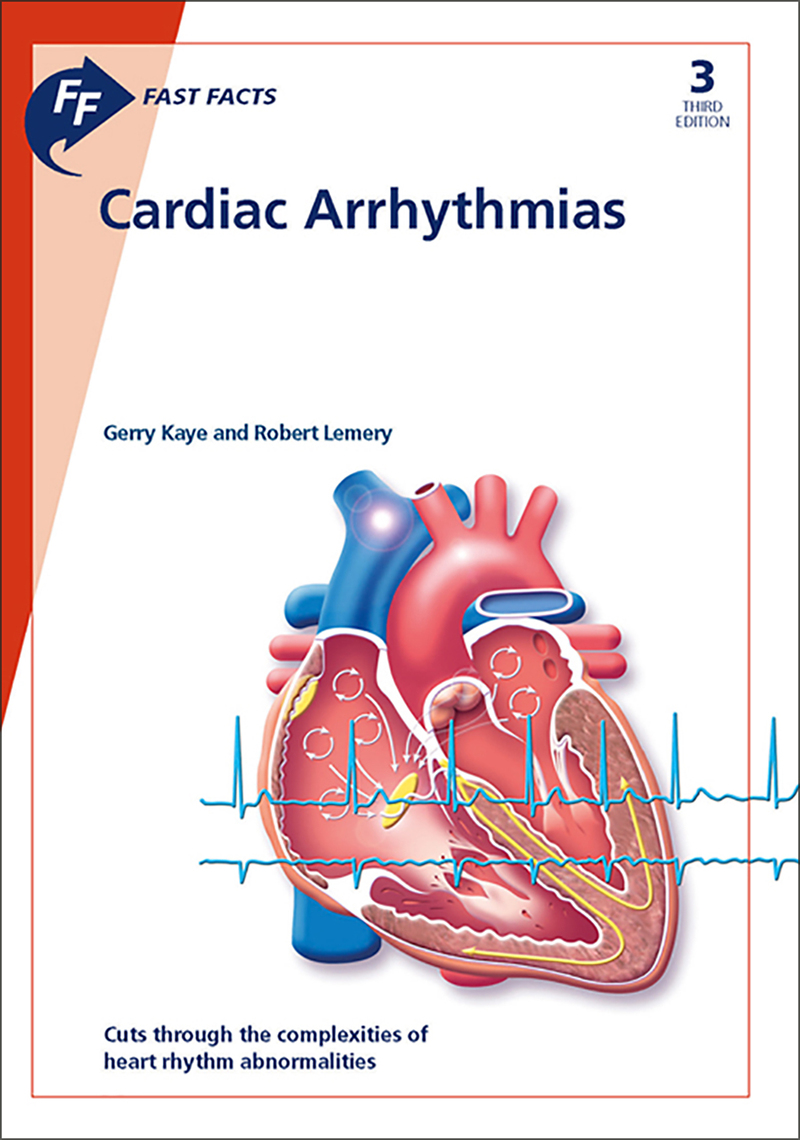 Fast Facts: Cardiac Arrhythmias by G. Kaye, R. Lemery (Ebook) - Read ...