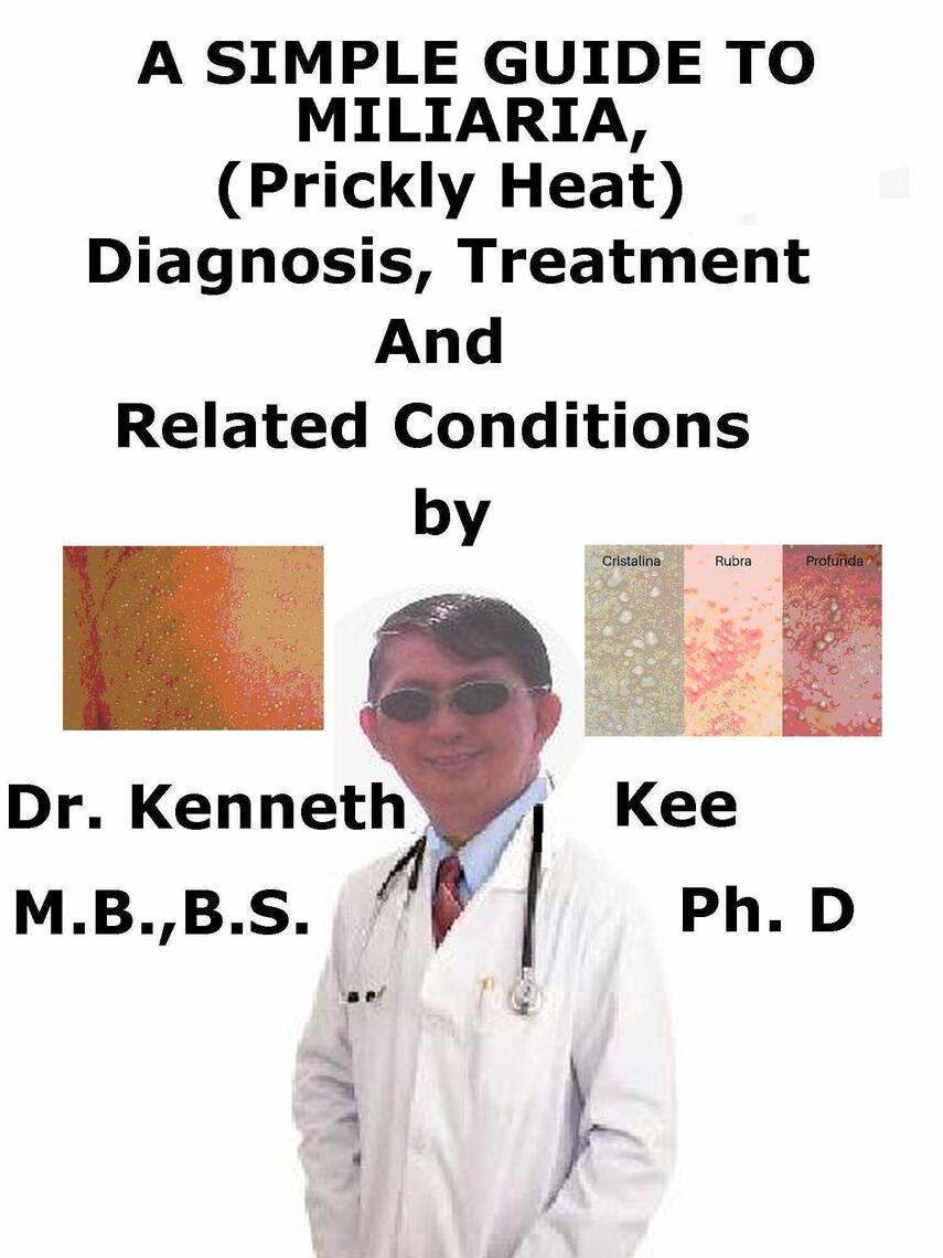 A Simple Guide To Miliaria, (Prickly Heat) Diagnosis, Treatment And ...