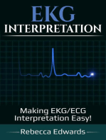 Basic EKG For Dummies | PDF | Electrocardiography | Heart Valve