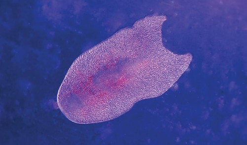 Decapitated Worms ‘See’ With Headless Bodies - How It Works | Everand