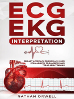 Delta Wave - LITFL Medical Blog - ECG Library Basics | PDF | Cardiac ...