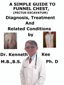 A Simple Guide to Funnel Chest (Pectus Excavatum), Diagnosis, Treatment ...