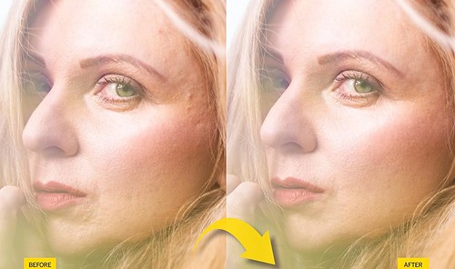 9 Enhance Your Portraits With The Spot Removal Tool - N-Photo: the ...