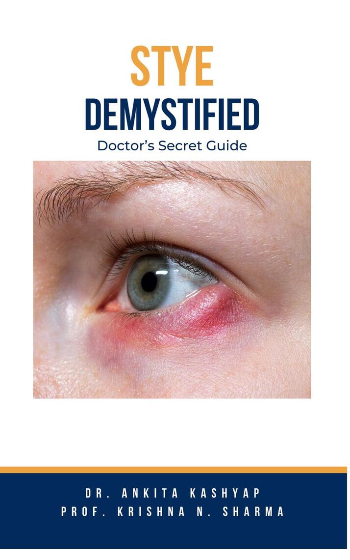 Stye Demystified: Doctor's Secret Guide by Dr. Ankita Kashyap, Prof ...