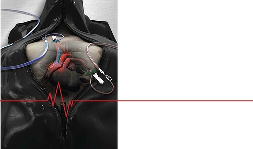 ORGAN RESURRECTION: Bringing Dead Organs To Life - Science Illustrated ...