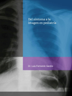 Mecanismo de Schultze | PDF | Placenta | Parto