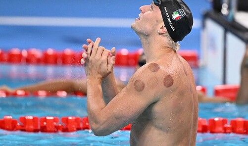 Olympics 2024: What Is Cupping And Why Do Swimmers Have Red Circles On ...
