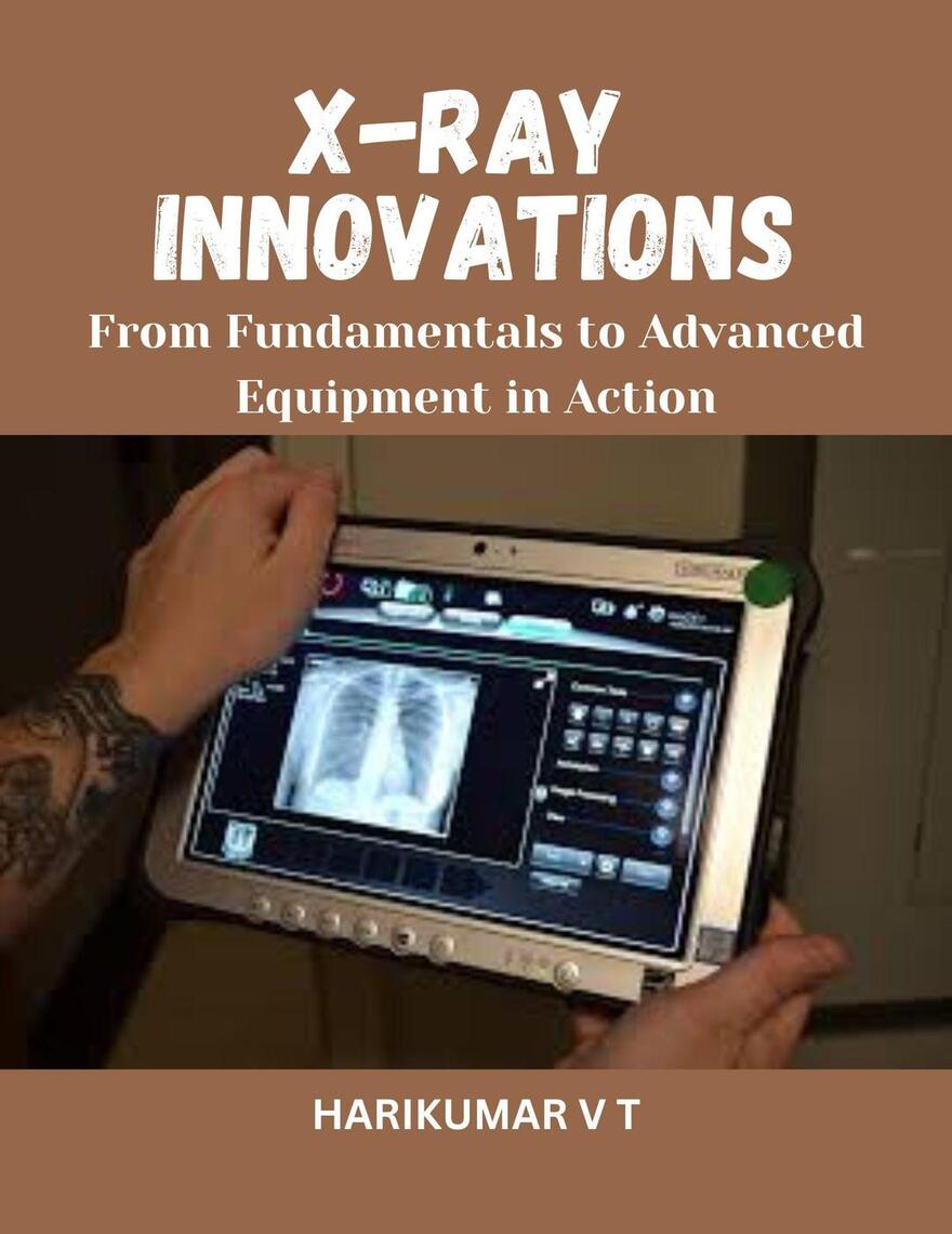 X-Ray Innovations: From Fundamentals to Advanced Equipment in Action by ...