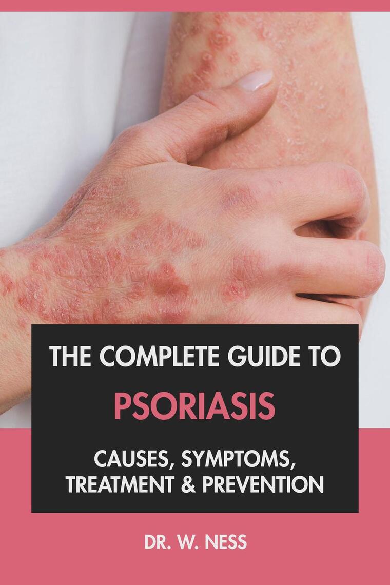 The Complete Guide to Psoriasis: Causes, Symptoms, Treatment ...