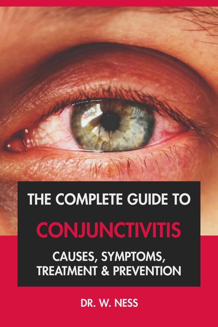 The Complete Guide to Conjunctivitis: Causes, Symptoms, Treatment ...