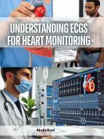 How to Read an ECG _ ECG Interpretation _ EKG _ Geeky Medics | PDF | Electrocardiography ...
