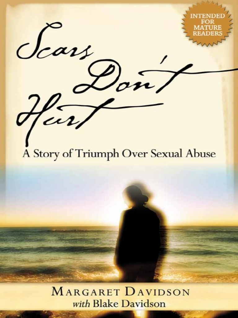 Scars Don't Hurt by Blake Davidson (Ebook) - Read free for 30 days